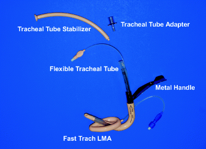Airway Management | SpringerLink