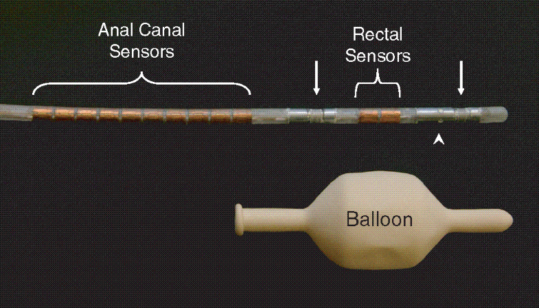 Anorectal Manometry | SpringerLink