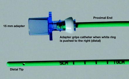 Special Airway Devices for Thoracic Anesthesia: CPAP, PEEP, and Airway ...