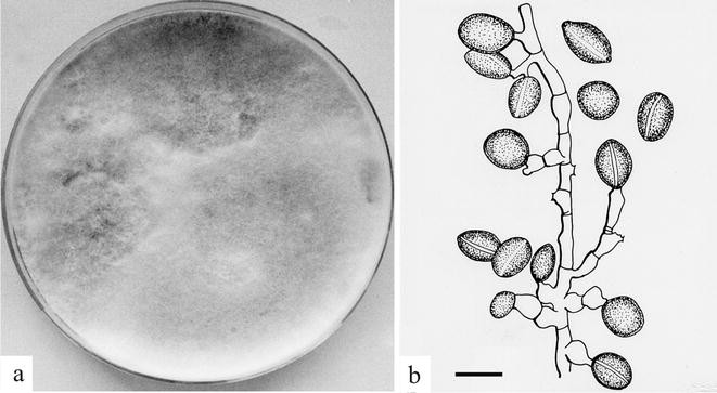 Primary Keys and Miscellaneous Fungi | SpringerLink