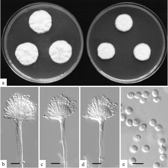 Aspergillus and Related Teleomorphs | SpringerLink