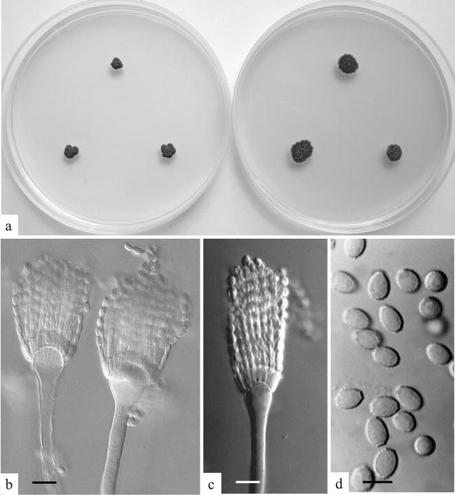Aspergillus and Related Teleomorphs | SpringerLink