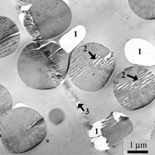 Artifacts in Transmission Electron Microscopy | SpringerLink
