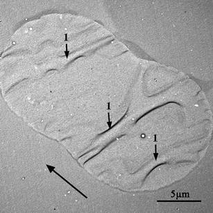 Artifacts in Transmission Electron Microscopy | SpringerLink