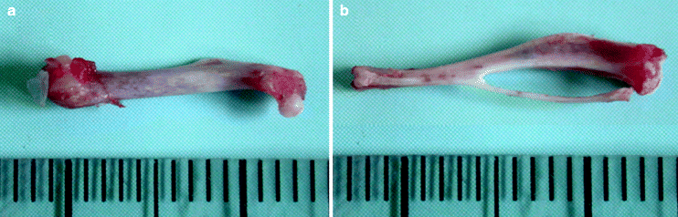 Mouse models for the Study of Fracture Healing and Bone Regeneration ...