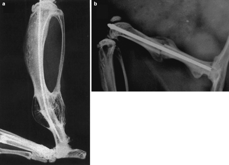 Mouse models for the Study of Fracture Healing and Bone Regeneration ...