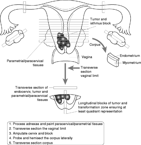 Cervix | SpringerLink