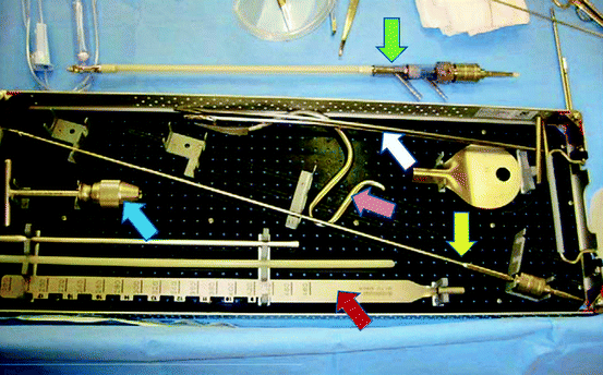 Autologous Bone Graft Harvesting with the Use of RIA (Reamer Irrigator ...