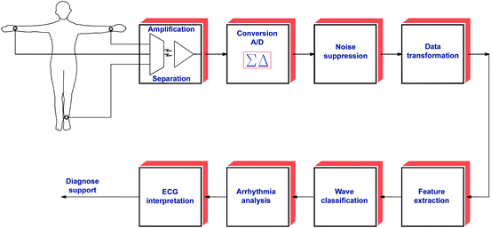 An Introduction to ECG Signal Processing and Analysis | SpringerLink