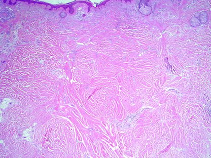 Differential Diagnosis of Normal Skin | SpringerLink