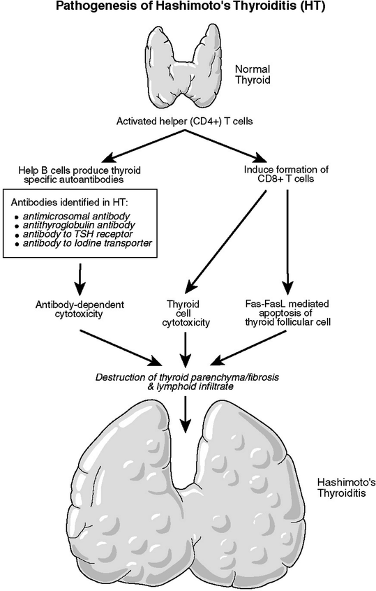 Pathology of Thyroid Gland | SpringerLink