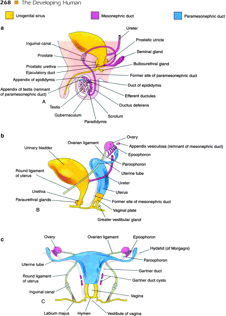 Müllerian (Paramesonephric) Anomalies and Associated Wolffian ...