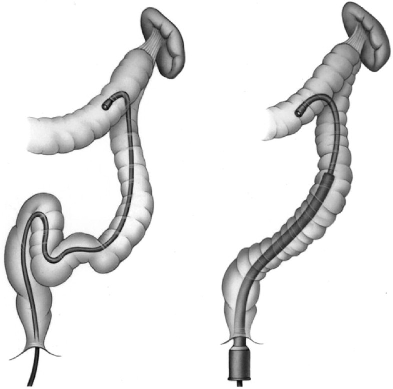 Endoscopy | SpringerLink