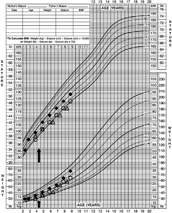 Growth in Duchenne Muscular Dystrophy | SpringerLink