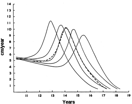 Growth Velocity Curves: What They Are and How to Use Them | SpringerLink