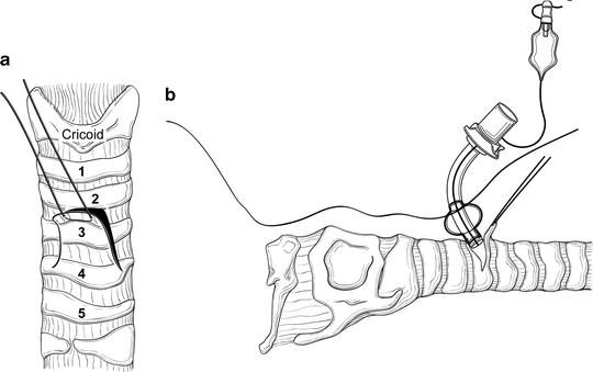Face, Eye, and Ear Injuries | SpringerLink