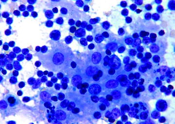 Cytology of Normal/Reactive Lymph Nodes | SpringerLink