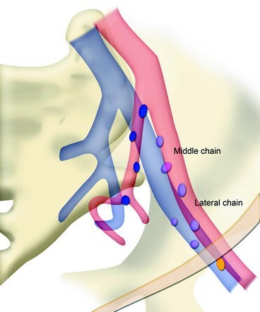 Pelvic Lymph Nodes | SpringerLink