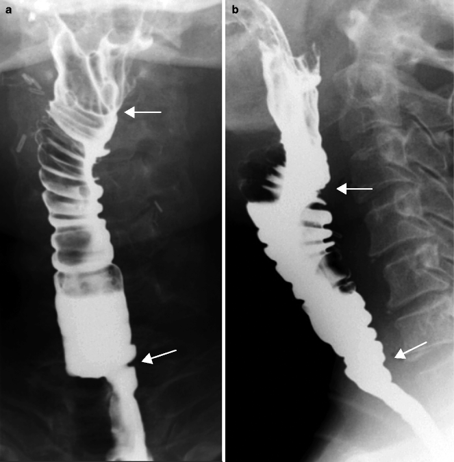 The Esophagus | SpringerLink