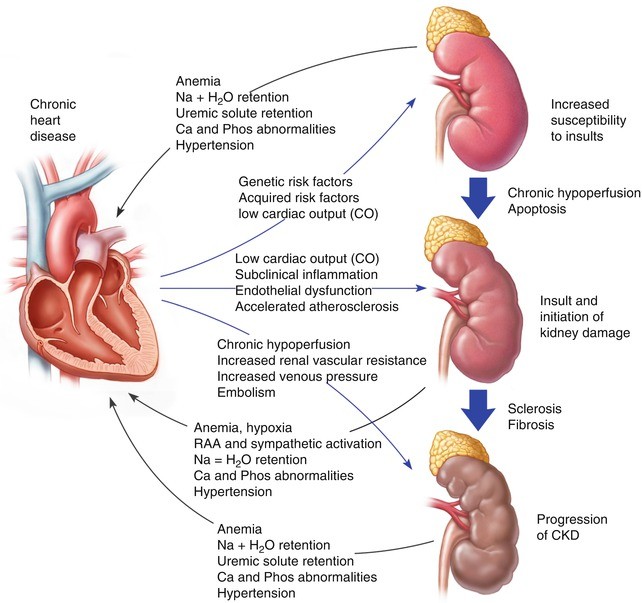 Cardiorenal Syndromes: Renal Artery Disease and Congestive Heart ...