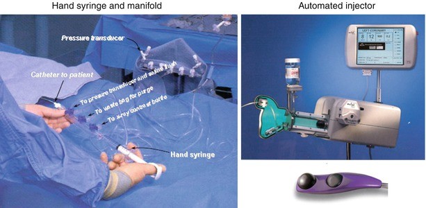 Coronary Angiography | SpringerLink
