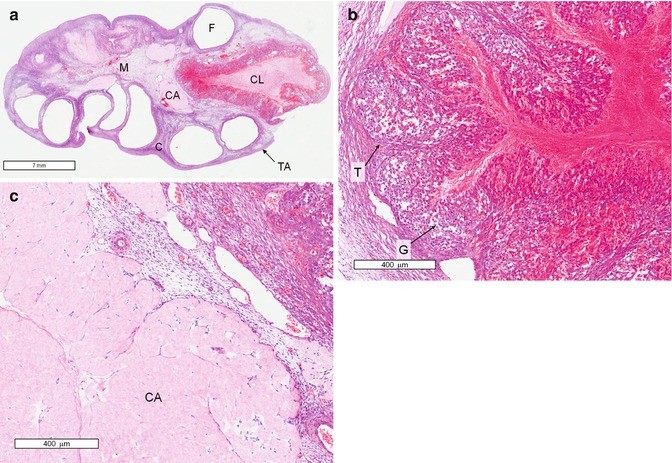 Anatomy, Development, Histology, and Normal Function of the Ovary ...