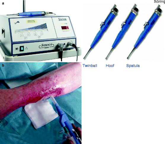 The Use of Biophysical Technologies in Chronic Wound Management ...