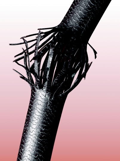 Trichorrhexis Nodosa | SpringerLink