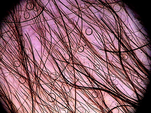 Hair Shafts | SpringerLink