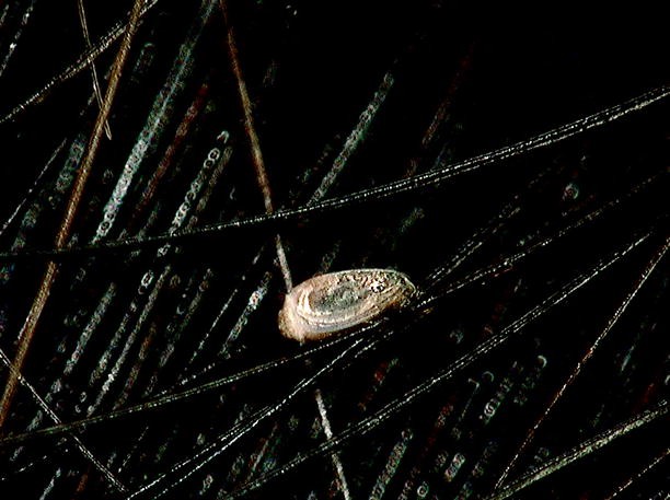 Parasitic Scalp Infections | SpringerLink