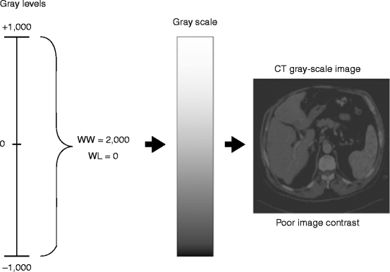 Computed Tomography: Physical Principles, Instrumentation, and Quality ...