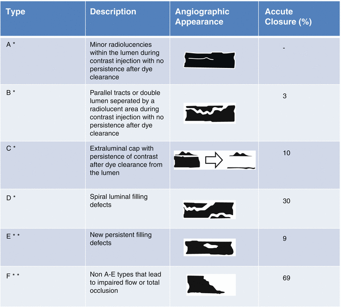Qualitative and Quantitative Coronary Angiography | SpringerLink
