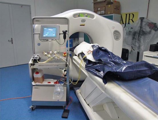 Postmortem Computed Tomography (PMCT) Scanning with Angiography (PMCTA ...