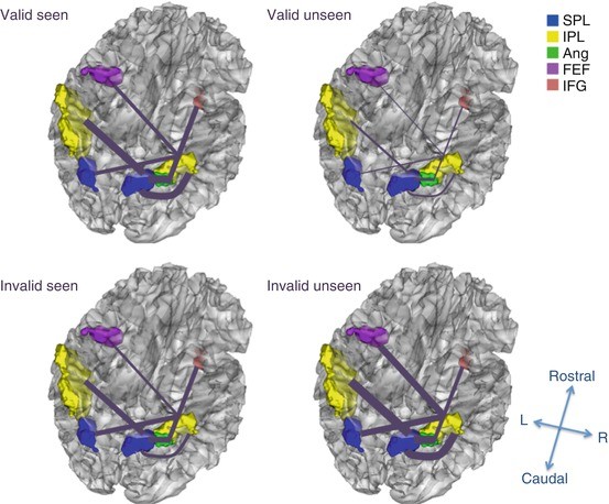 The Attention Systems of the Human Brain | SpringerLink