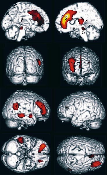 The Attention Systems of the Human Brain | SpringerLink