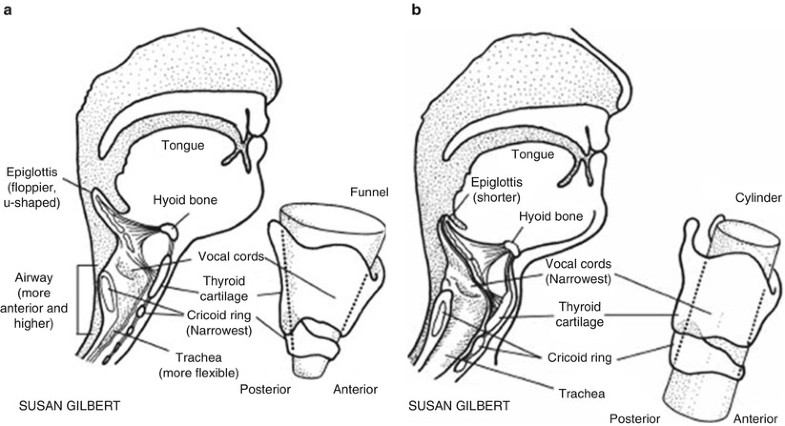 Basic Management of the Pediatric Airway | SpringerLink