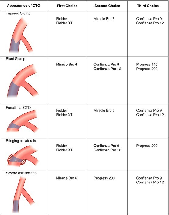 Chronic Total Occlusions | SpringerLink