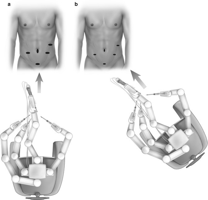 Abdominoperineal Resection | SpringerLink
