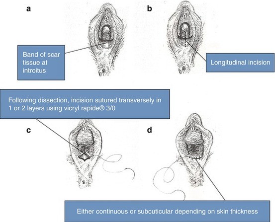Healing Process and Complications | SpringerLink