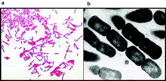 Kingella kingae Infections in Children: An Update | SpringerLink