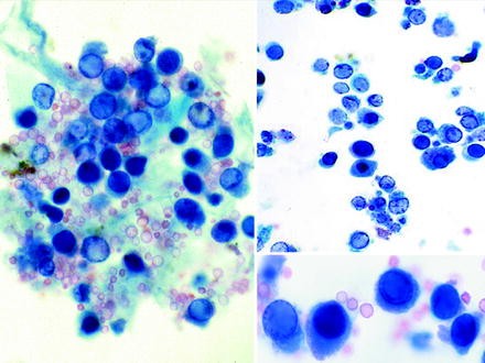 Urinary Tract Infections | SpringerLink