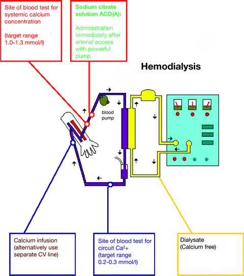 Technical Aspects of Hemodialysis in Children | SpringerLink
