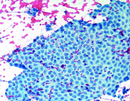 Normal Cytology | SpringerLink