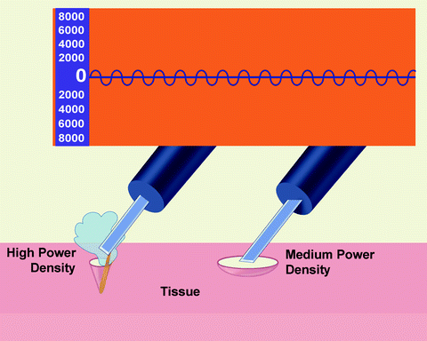 Fundamentals of Electrosurgery Part I: Principles of Radiofrequency ...