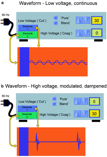 Fundamentals of Electrosurgery Part I: Principles of Radiofrequency ...