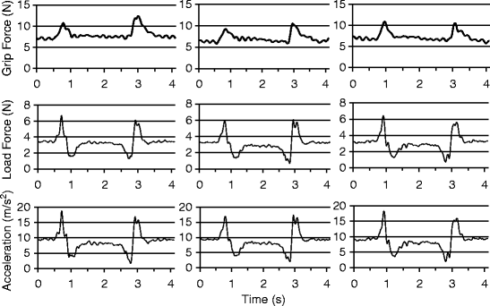 Isometric Tremor | SpringerLink