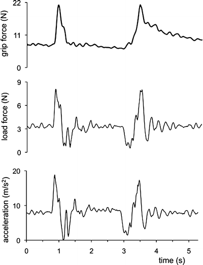 Isometric Tremor | SpringerLink