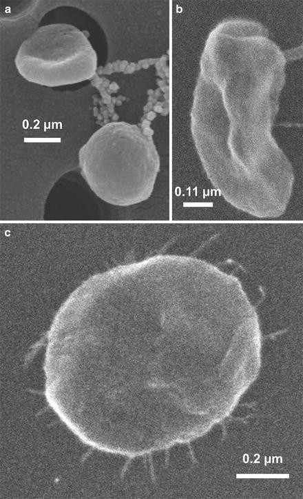Dehalococcoides and Reductive Dechlorination of Chlorinated Solvents ...