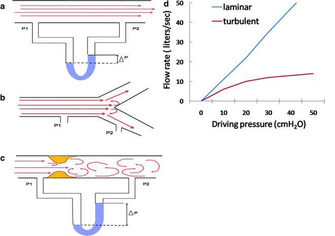 Physiology of Fixed Airway Obstruction | SpringerLink