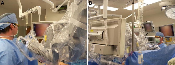 Robot-Assisted Radical Cystectomy: Room Setup, Patient Positioning ...